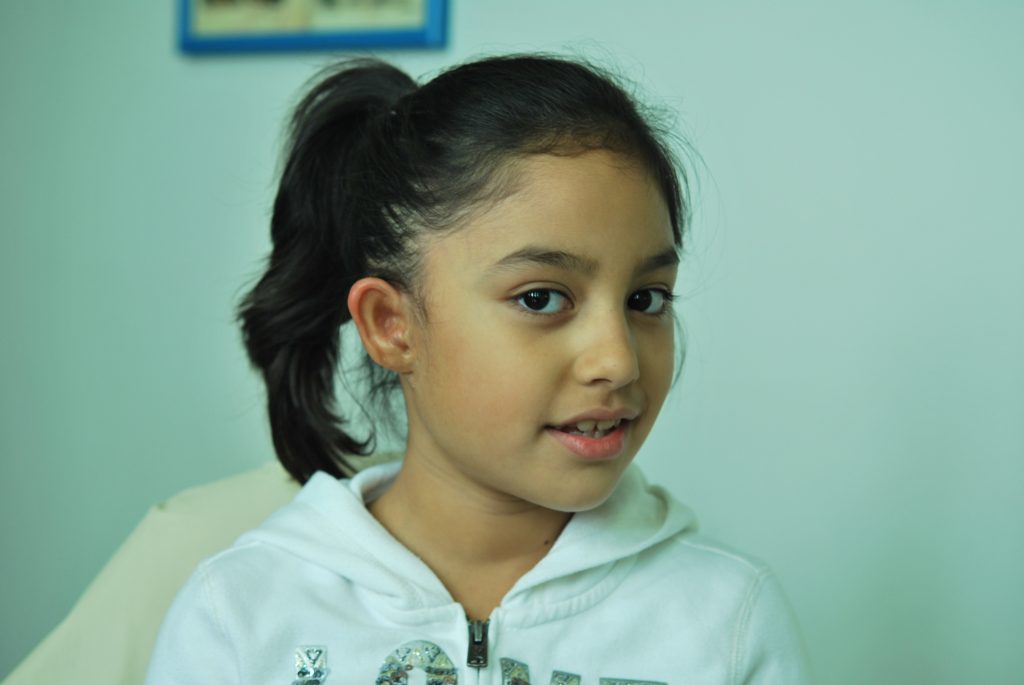Prosthetic ear