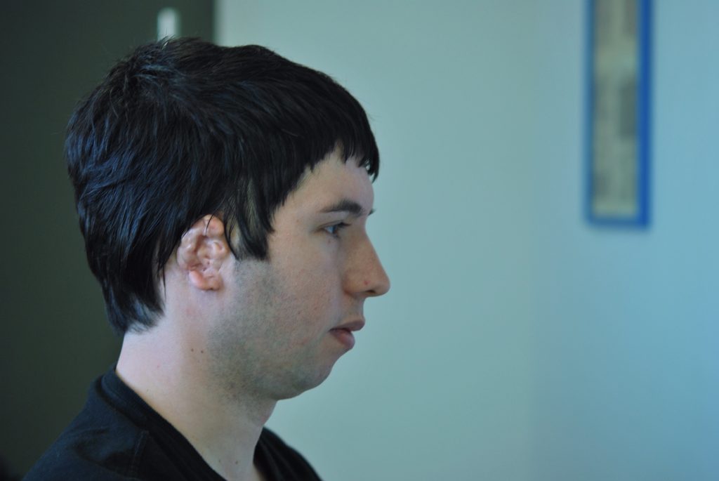 Prosthetic ear