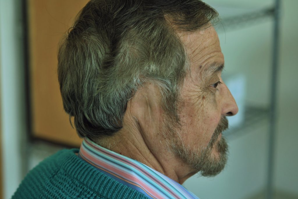 Prosthetic ear