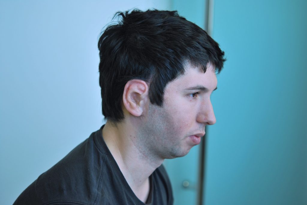 Prosthetic ear