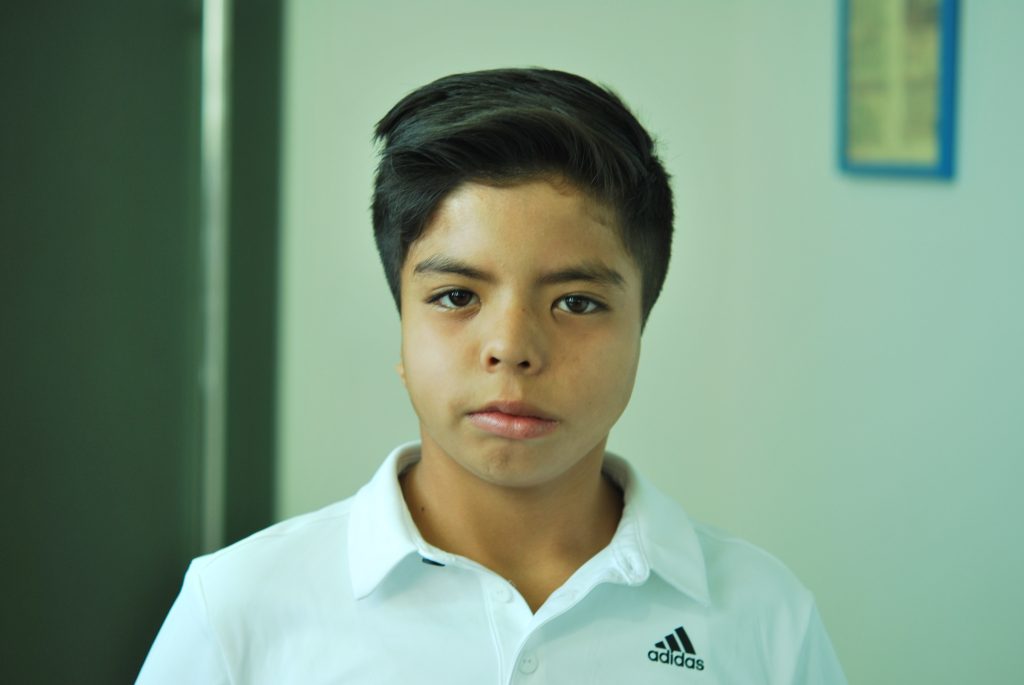 Prosthetic ear