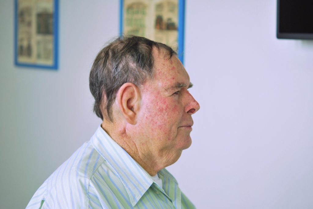 Prosthetic ear