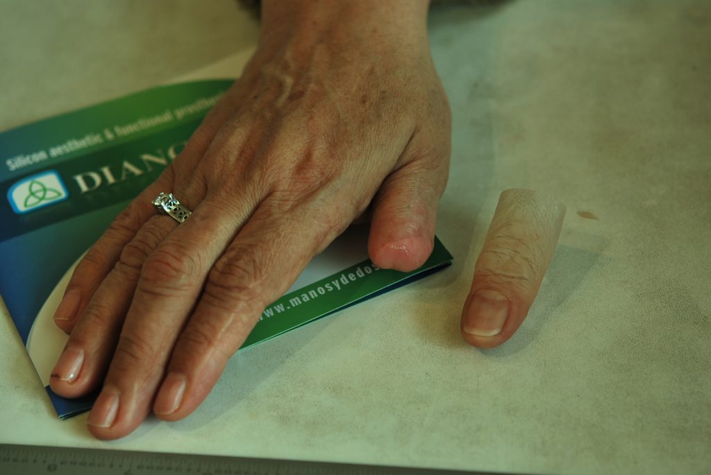 Prosthetic finger