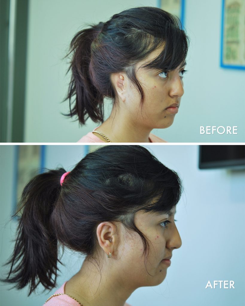 Prosthetic ear
