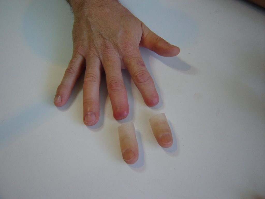 Prosthetic finger