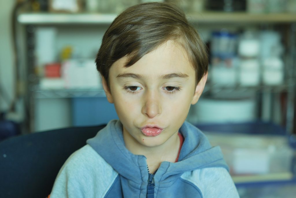 Prosthetic nose